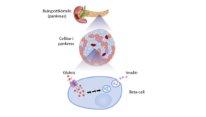 Metabola syndromet: från riskfaktorer till diabetes och hjärtsjukdomar ...